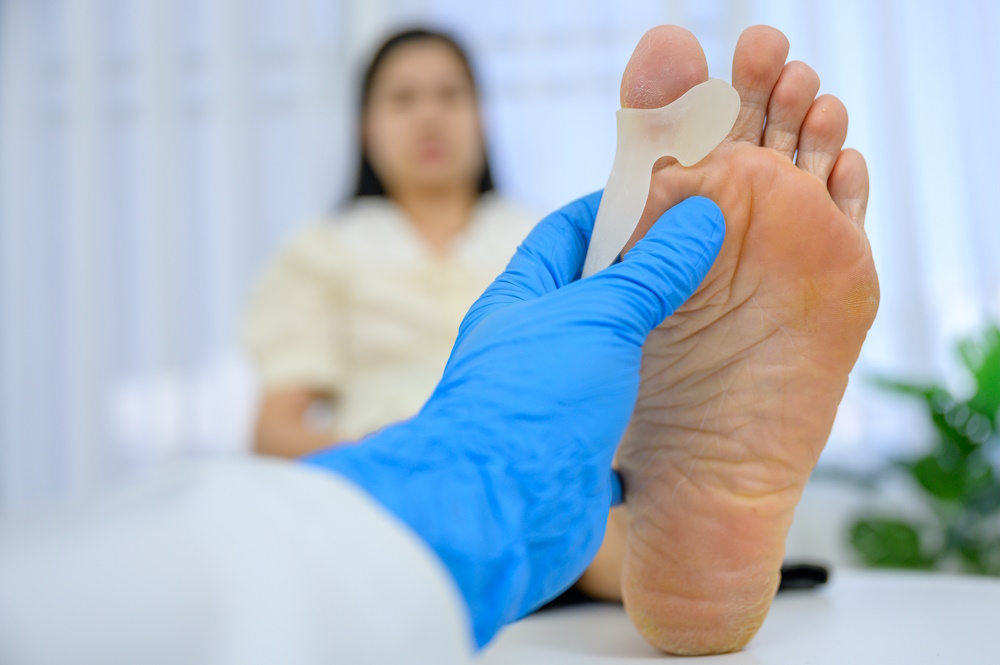 How To Get A VA Rating For Flat Feet Benefits We Make How To Get A VA Rating For Flat Feet Benefits We Make